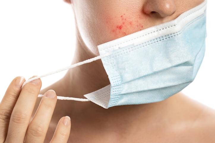 How do I protect my skin under a surgical mask | Watsons Thailand