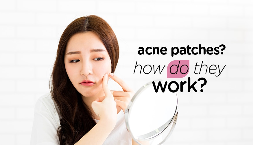 What are acne patches? How do they work?
