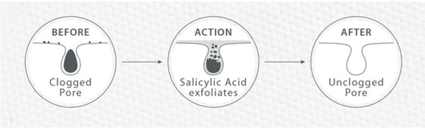 What are acne patches? How do they work?