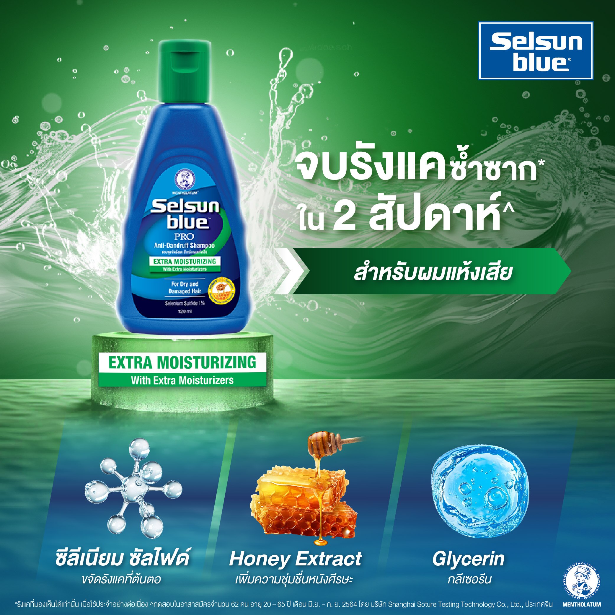 รังแค…สัญญาณ ที่บอกว่าหนังศีรษะของคุณต้องได้รับการดูแล จริงจัง