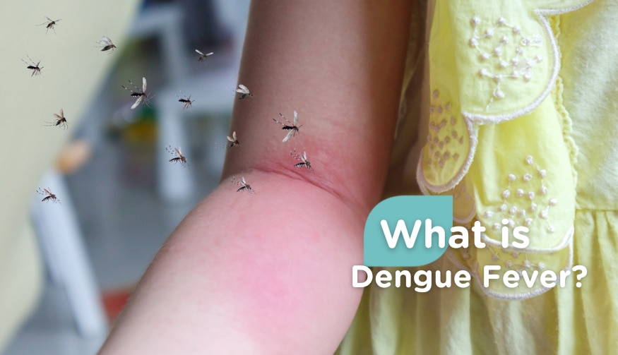 Dengue, Dengue fever, Dengue symptoms and treatments, Health